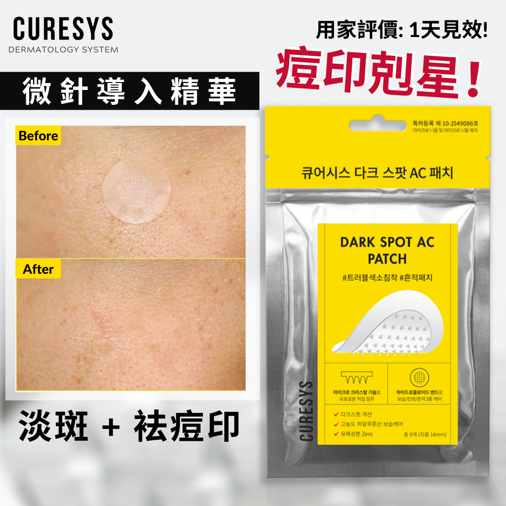 CURESYS - 微針淡斑去痘印貼 Dark Spot AC Patch – Lady Avenue